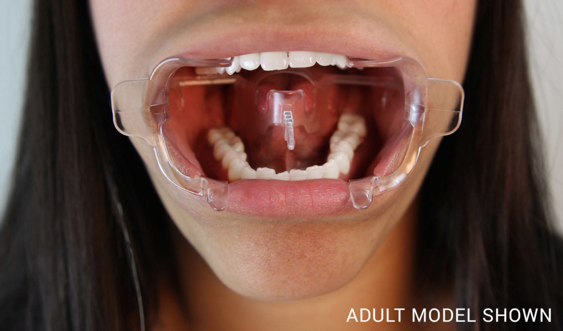 ClearField Jr. Cheek Retractors (box of 12) – The Paediatric Dental Company